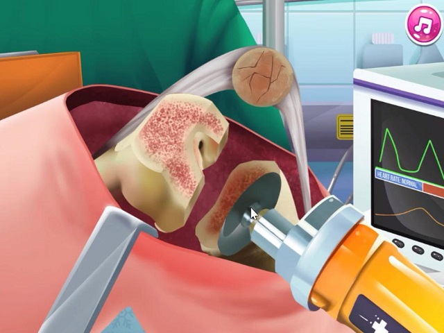KNEE SURGERY SIMULATOR juego online en JuegosJuegos.com